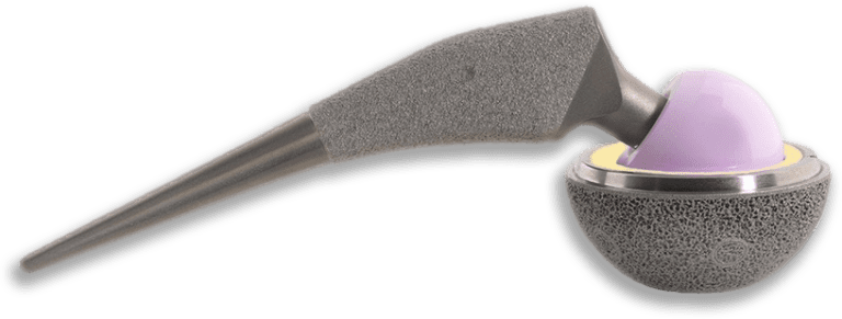 Implantcast North America | Orthopedic Medical Devices